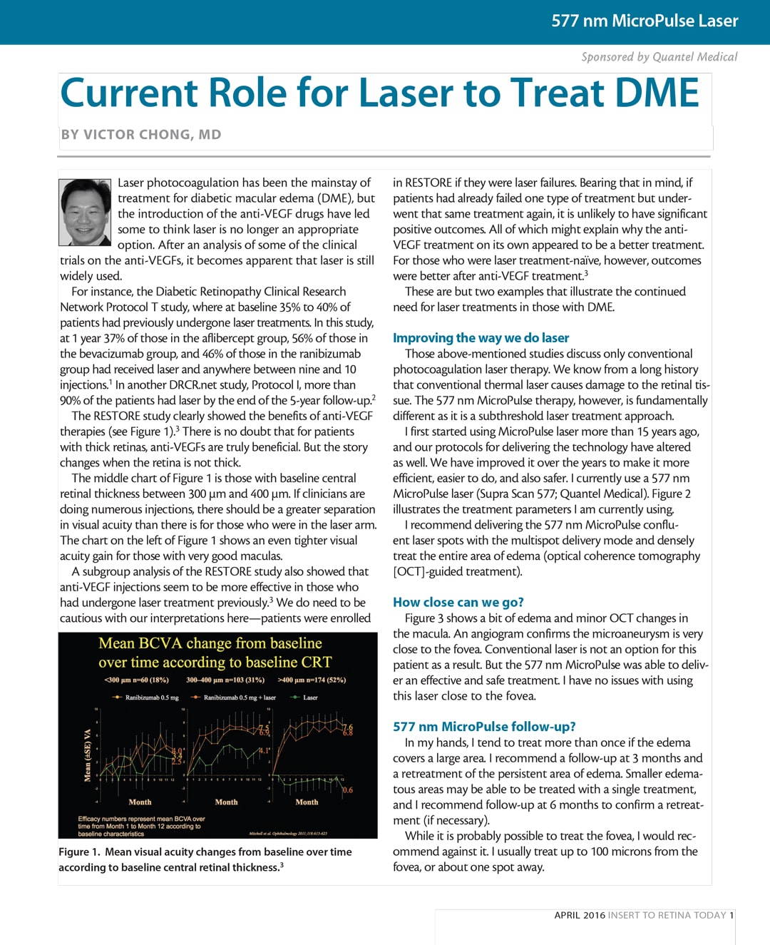 Current Role for Laser to Treat DME - Subliminal Laser Therapy