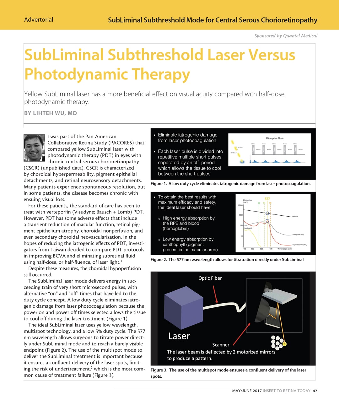 SubLiminal Subthreshold Laser Versus Photodynamic Therapy - Subliminal ...