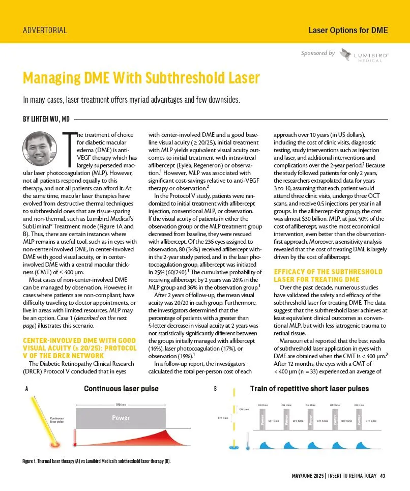 Managing DME With Subthreshold Laser - Subliminal Laser Therapy